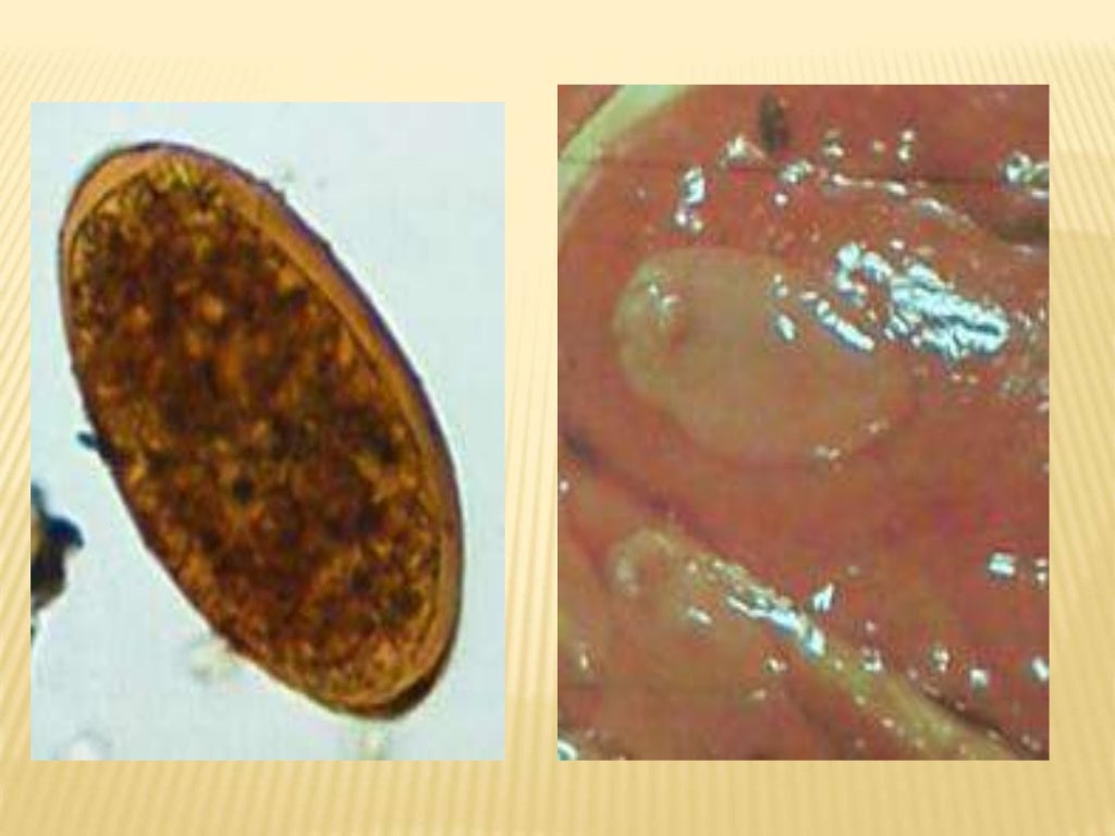 generalidades de los trematodos