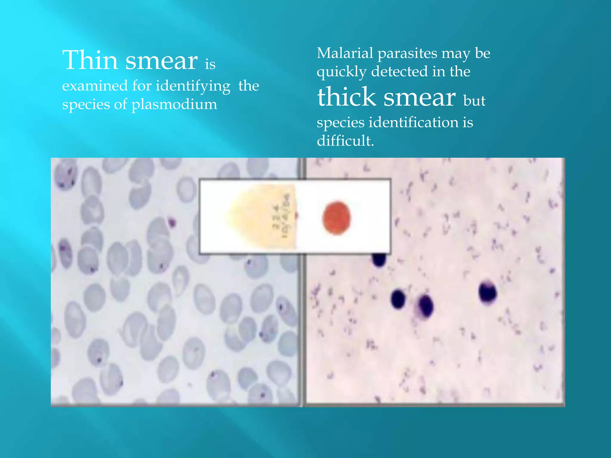 Parasitology (plasmodium) | PPTX