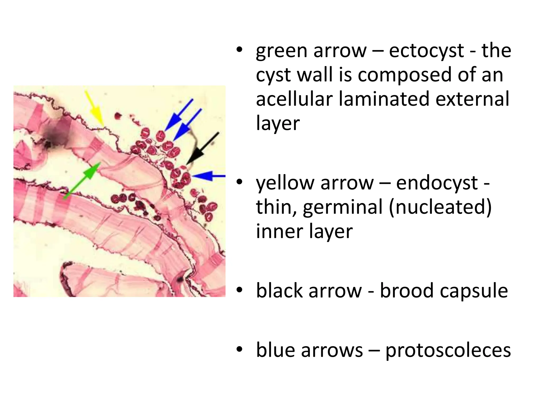 Parasitology-images for neet pgs and ugs | PPTX