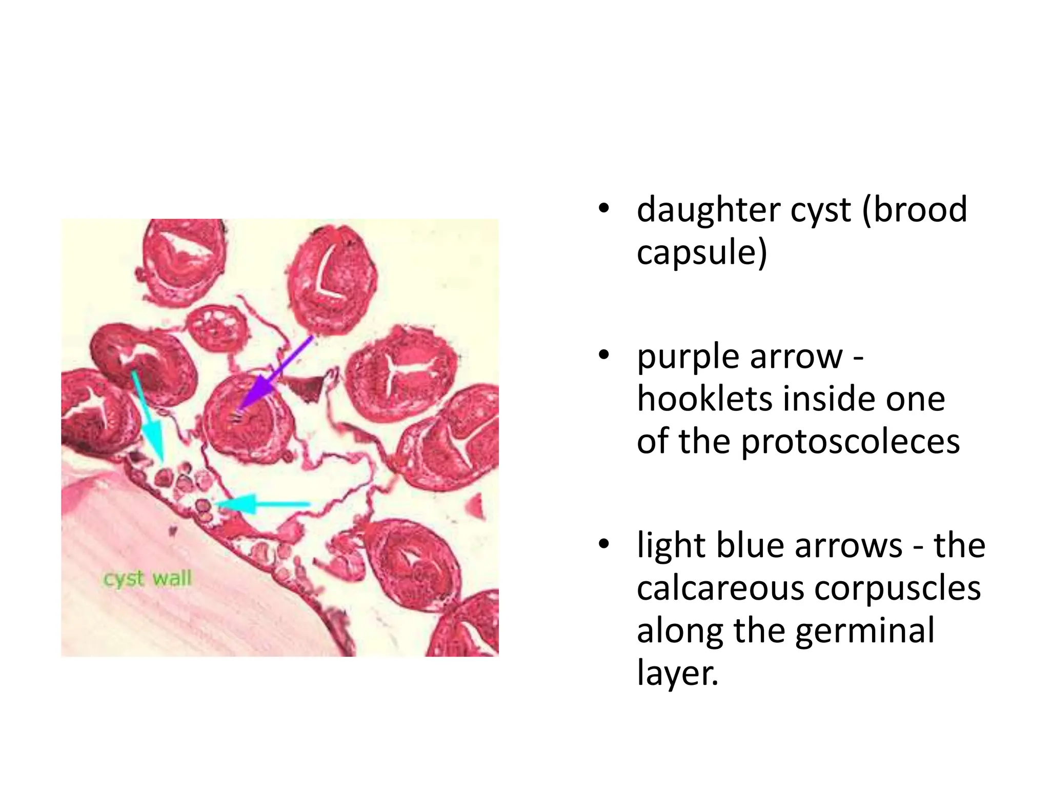 Parasitology-images for neet pgs and ugs | PPTX