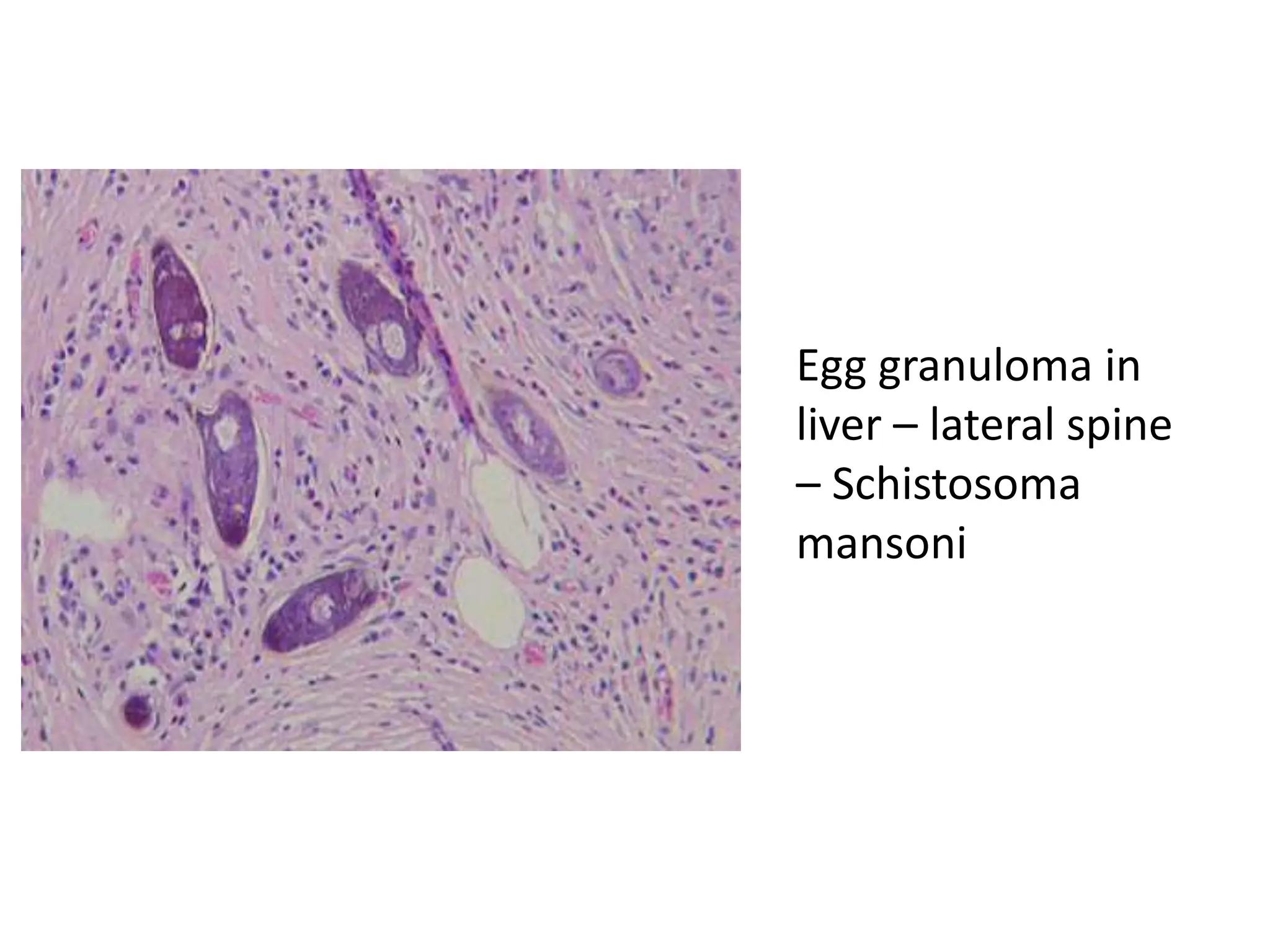 Parasitology-images for neet pgs and ugs | PPTX