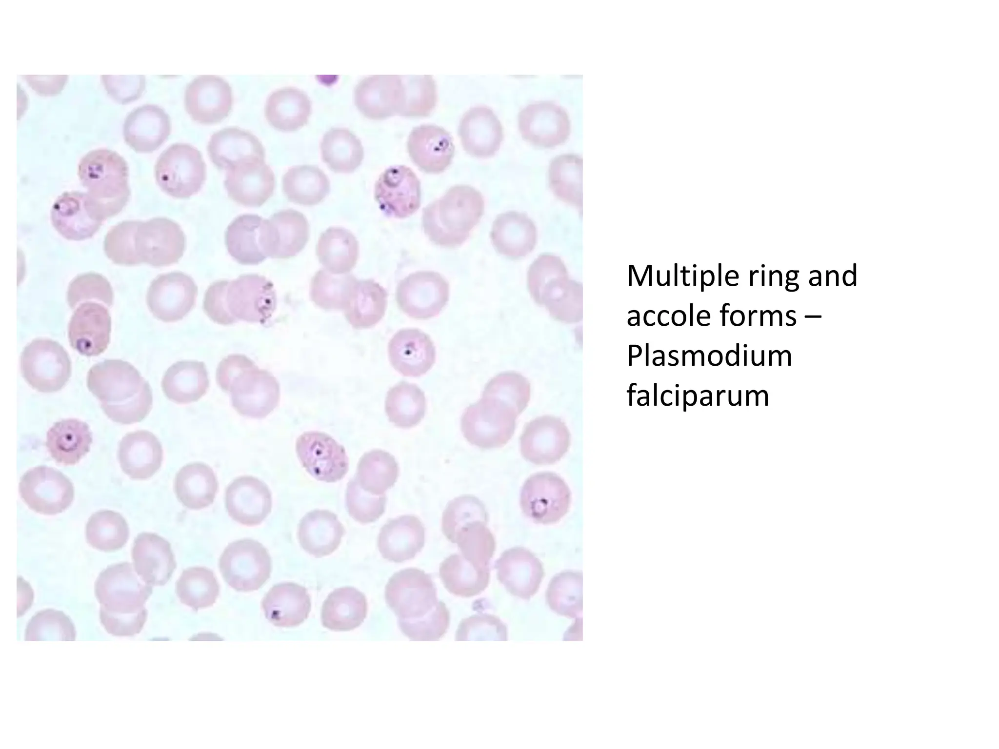 Parasitology-images for neet pgs and ugs | PPTX