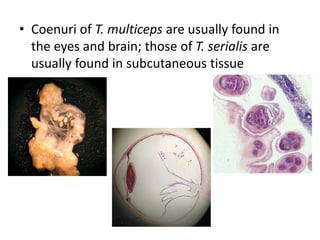 Parasitology-images for neet pgs and ugs | PPTX