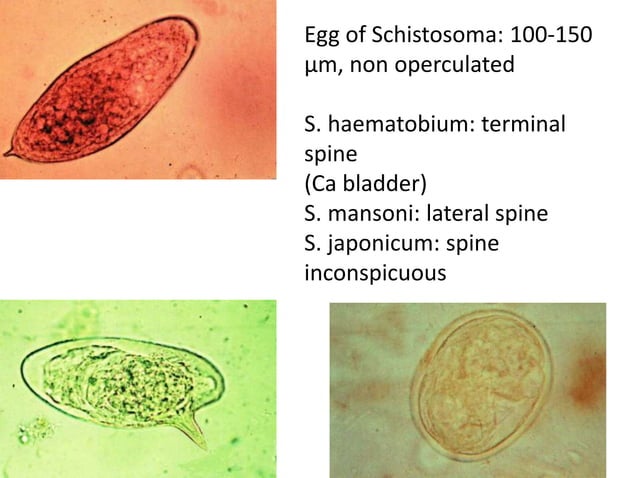Parasitology-images for neet pgs and ugs | PPTX