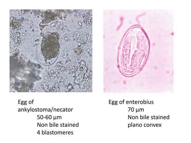 Parasitology-images for neet pgs and ugs | PPTX