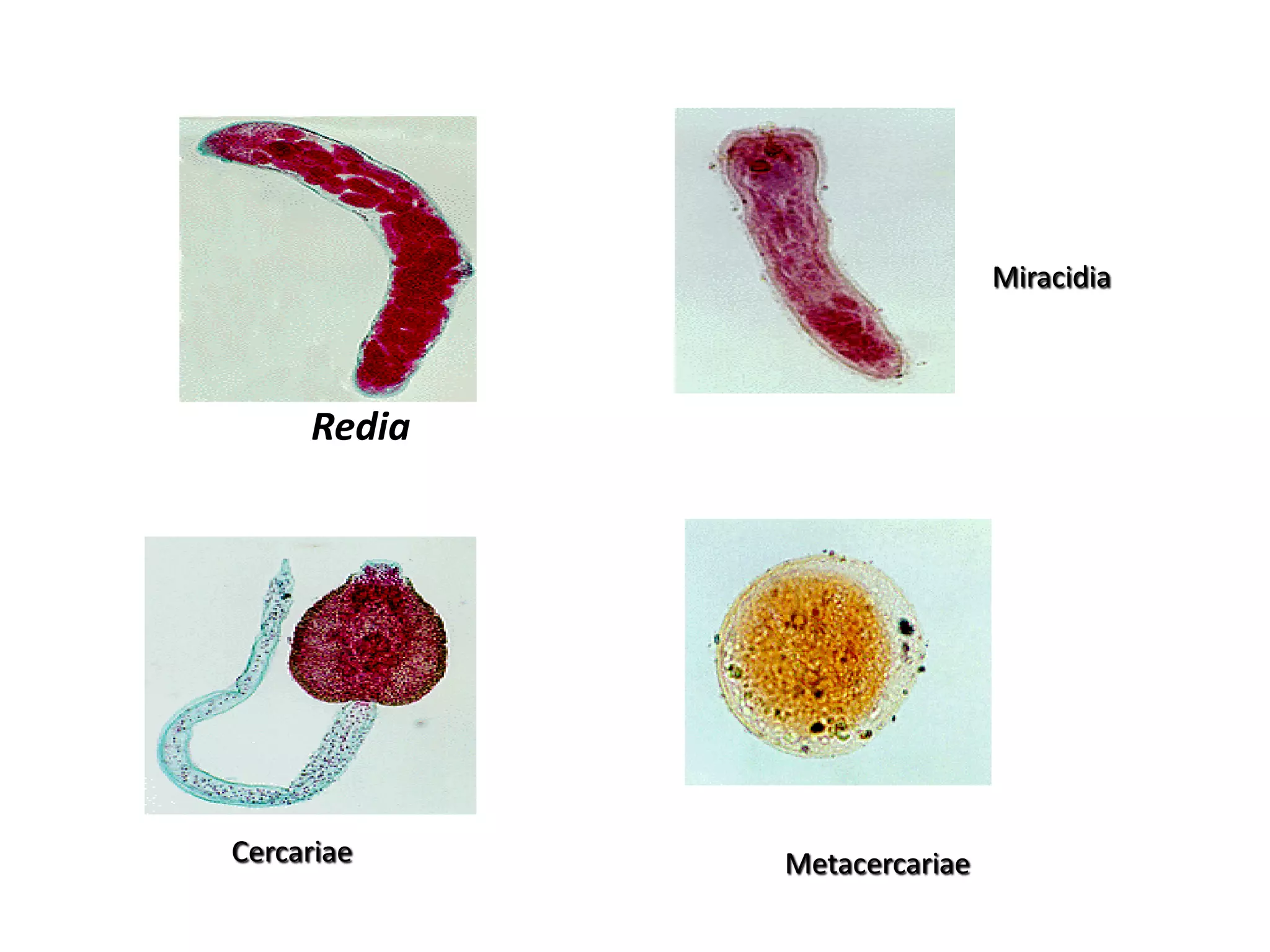 Introduction to class Trematoda and Fasciola hepatica | PDF