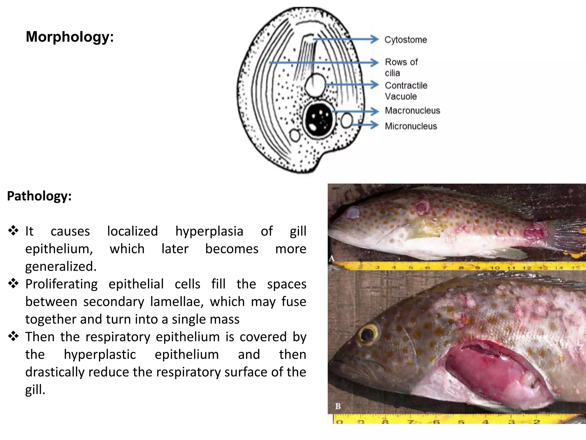 Life cycle of Protozoan parasite | PPTX