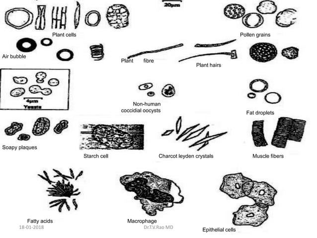 Parasitology Basic Identification methods | PPTX | Infectious Diseases ...