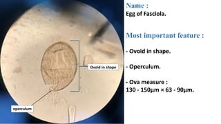 Parasitology (introduction to medical para and trematodes and cestodes ...