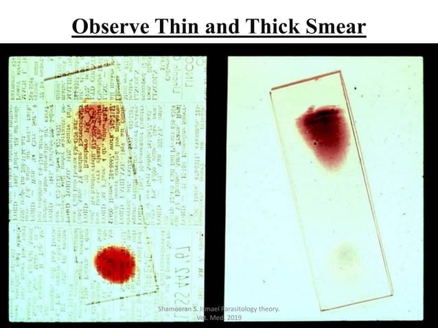 Parasitology paractice: Quantitative fecal Methods and Blood smear ...