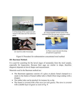 The Routine Parasitological Practice Methods | PDF