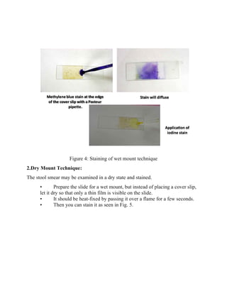 The Routine Parasitological Practice Methods | PDF
