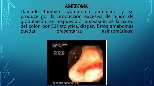 Parasitosis.... informatica