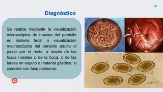 Parasitosis Humanas Intestinales en Pediatría | PPTX