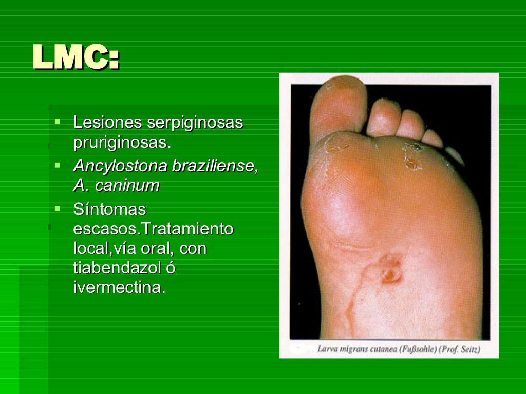 Parasitosis De Piel, Larva Migrante Cutanea Y Artropodos