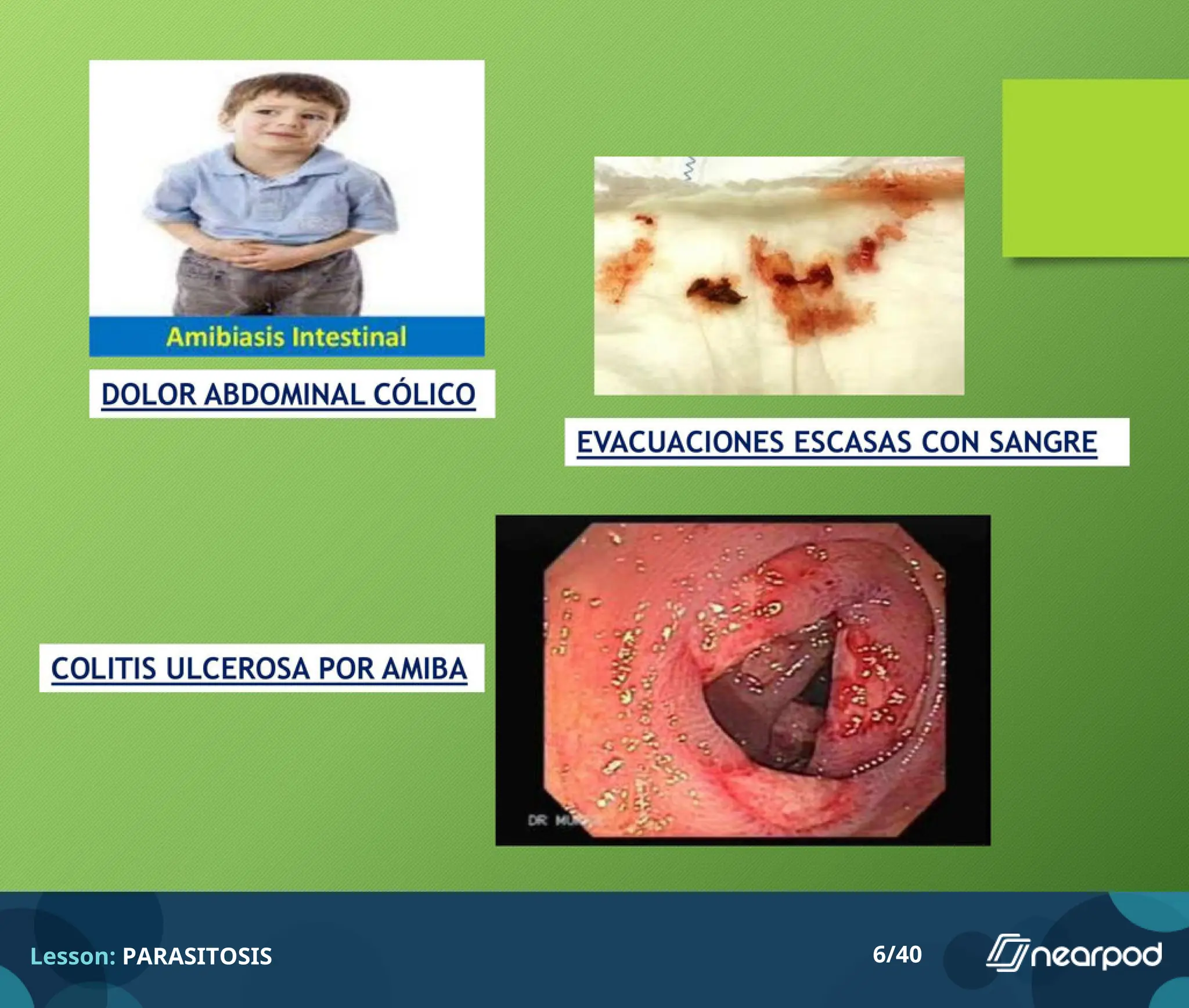 PARASITOSIS INTESTINALES EN PEDIATRIA.pdf