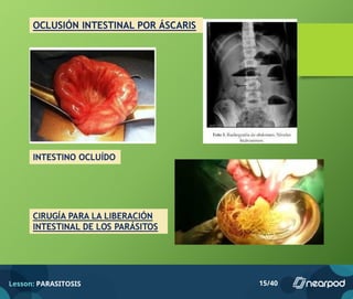 PARASITOSIS INTESTINALES EN PEDIATRIA.pdf