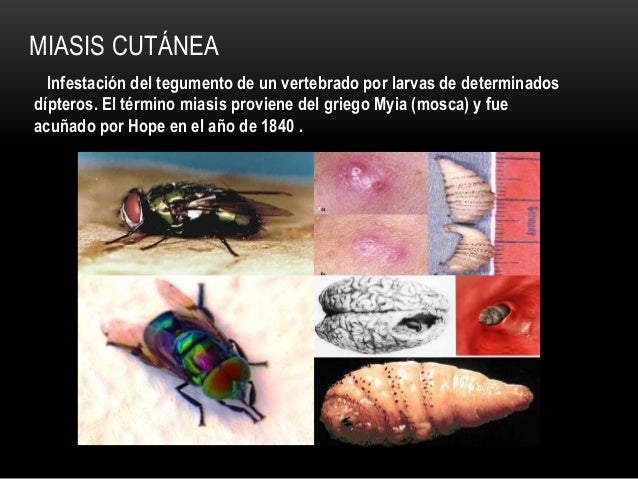 Parasitosis de la piel