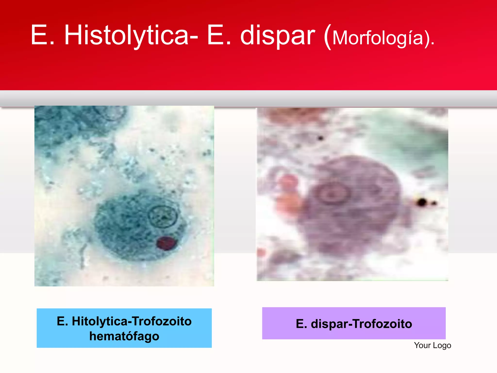 Parasitosis intestinal | PPTX