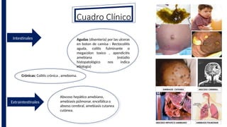 Comprehensive Overview of Intestinal Parasitosis: Causes, Symptoms ...