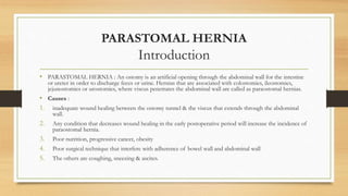 Parastomal Hernia ppt | PPTX