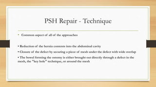Parastomal Hernia ppt | PPTX