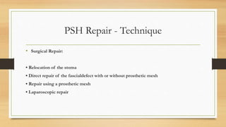 Parastomal Hernia ppt | PPTX
