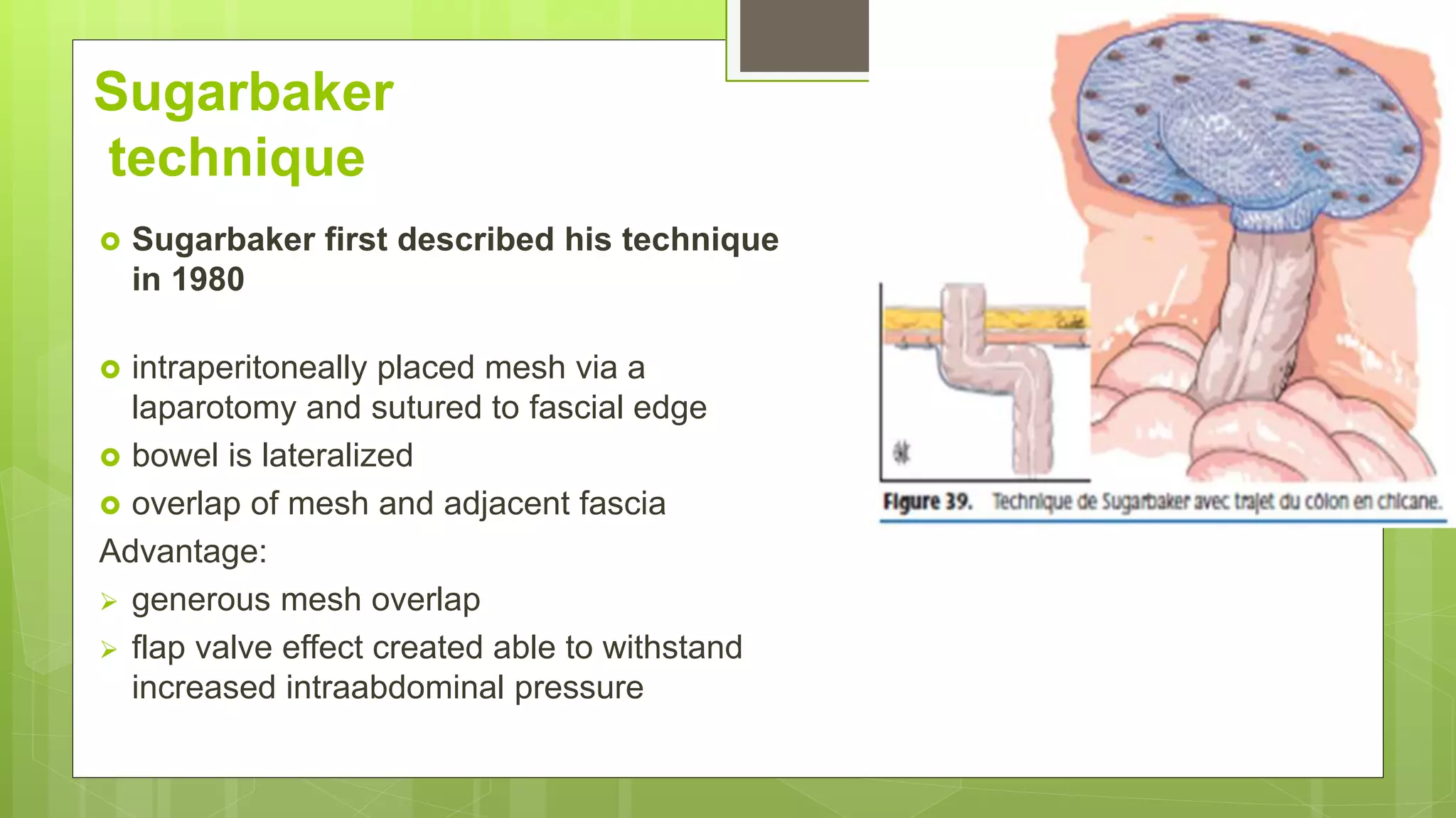 Parastomal hernia | PPTX