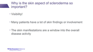 Skin Signs of Scleroderma: A Dermatological Approach to Diagnosis and ...