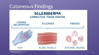 Skin Signs of Scleroderma: A Dermatological Approach to Diagnosis and ...