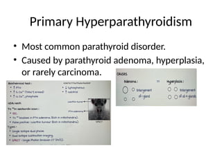 Parathyroid Diseases in detail from anat to surgery | PPTX