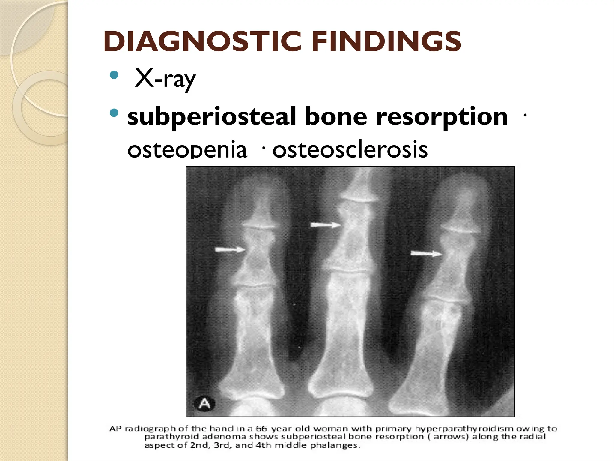 Parathyroid Disorder.pptx for bachelor of nursing | PPTX