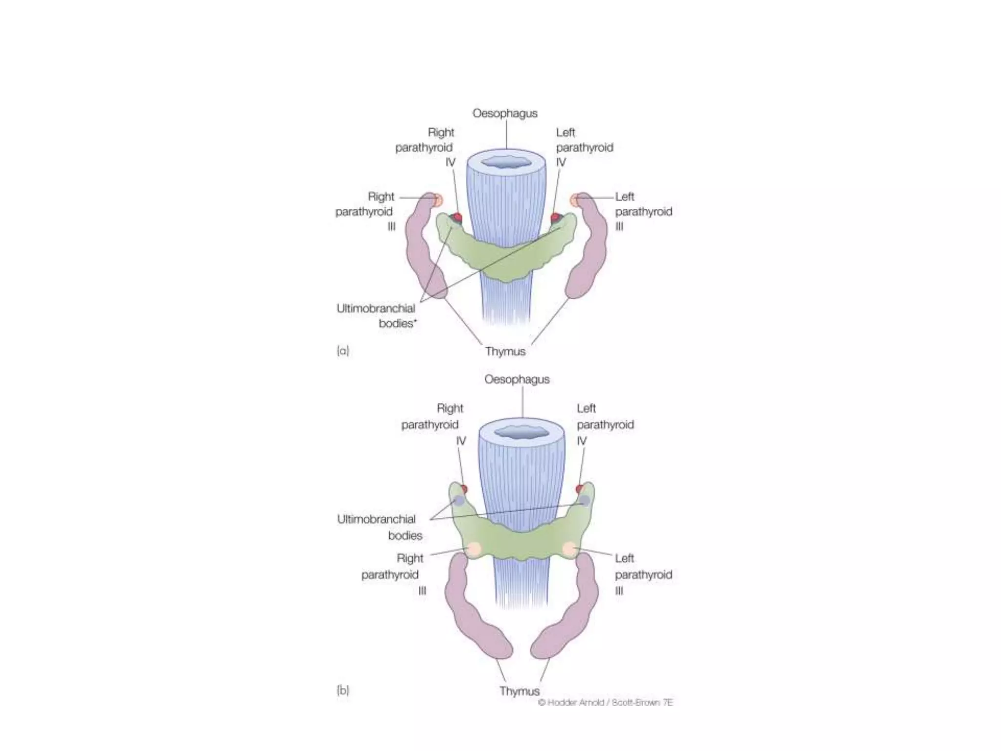 Parathyroid Dysfunction Pptx 7994