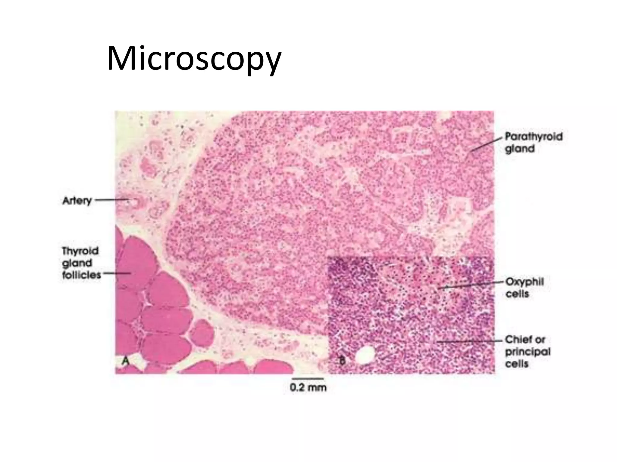 Parathyroid Dysfunction Pptx 8184