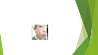 Approach to Parathyroid gland case ppptx | PPTX