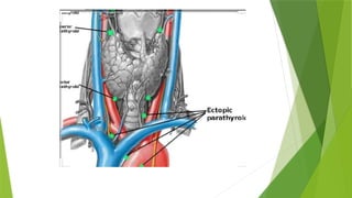 Approach to Parathyroid gland case ppptx | PPTX