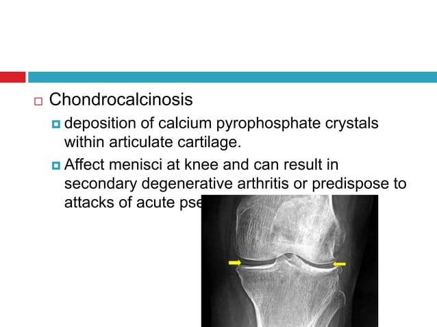 Parathyroid gland disorders and tetany | PPT