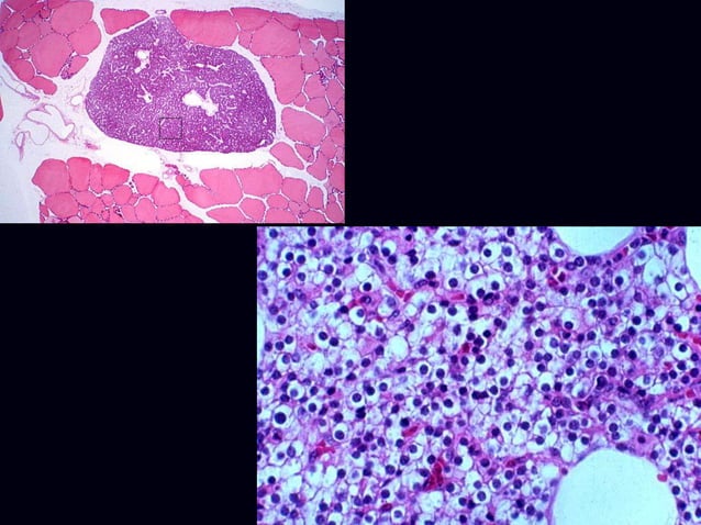 PARATHYROID GLANDS AND PATHOLOGY OF IT.pptx