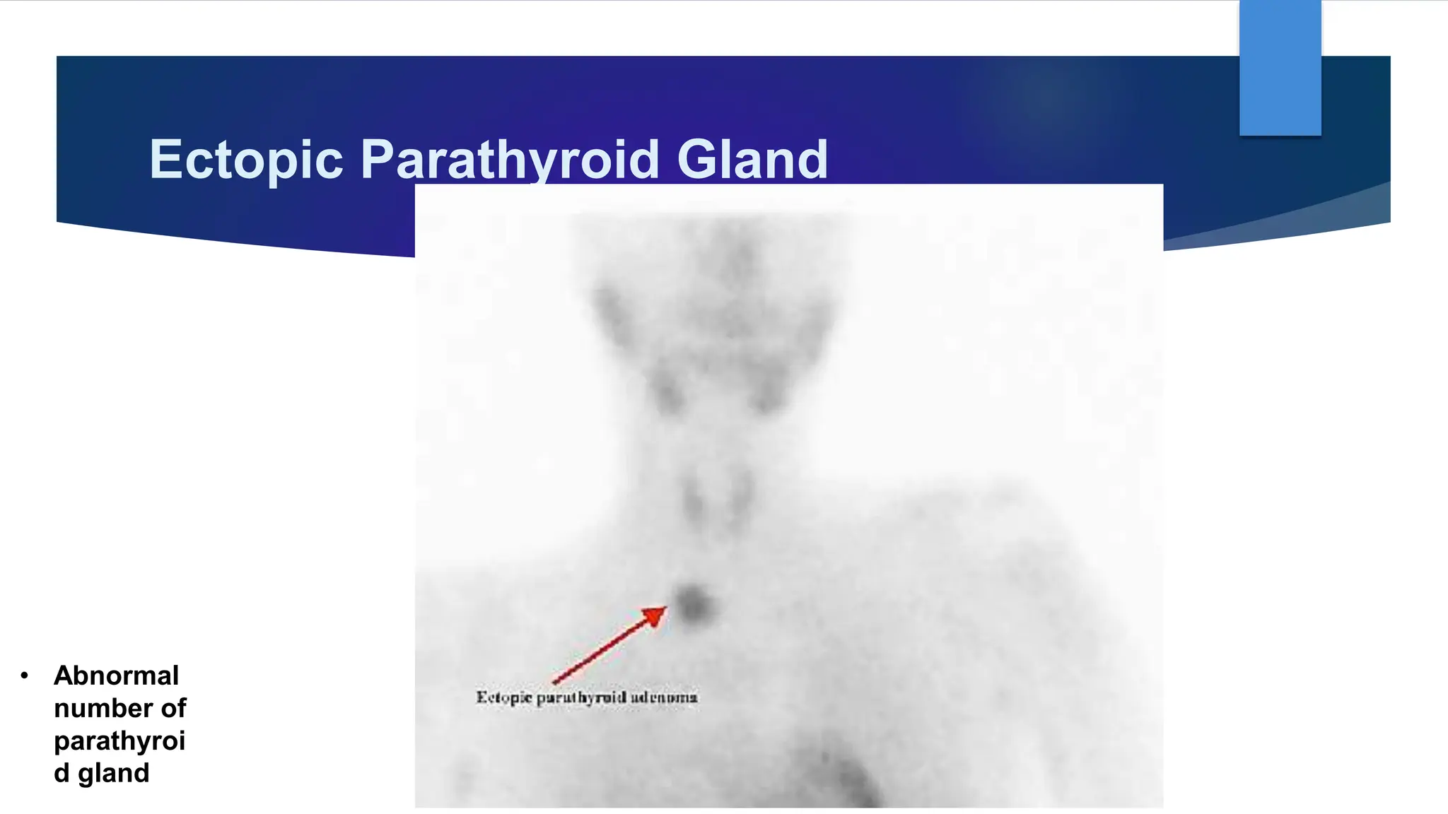 Parathyroid Glands- Gross Anatomy & Histology by Dr. Rabia Inam ...