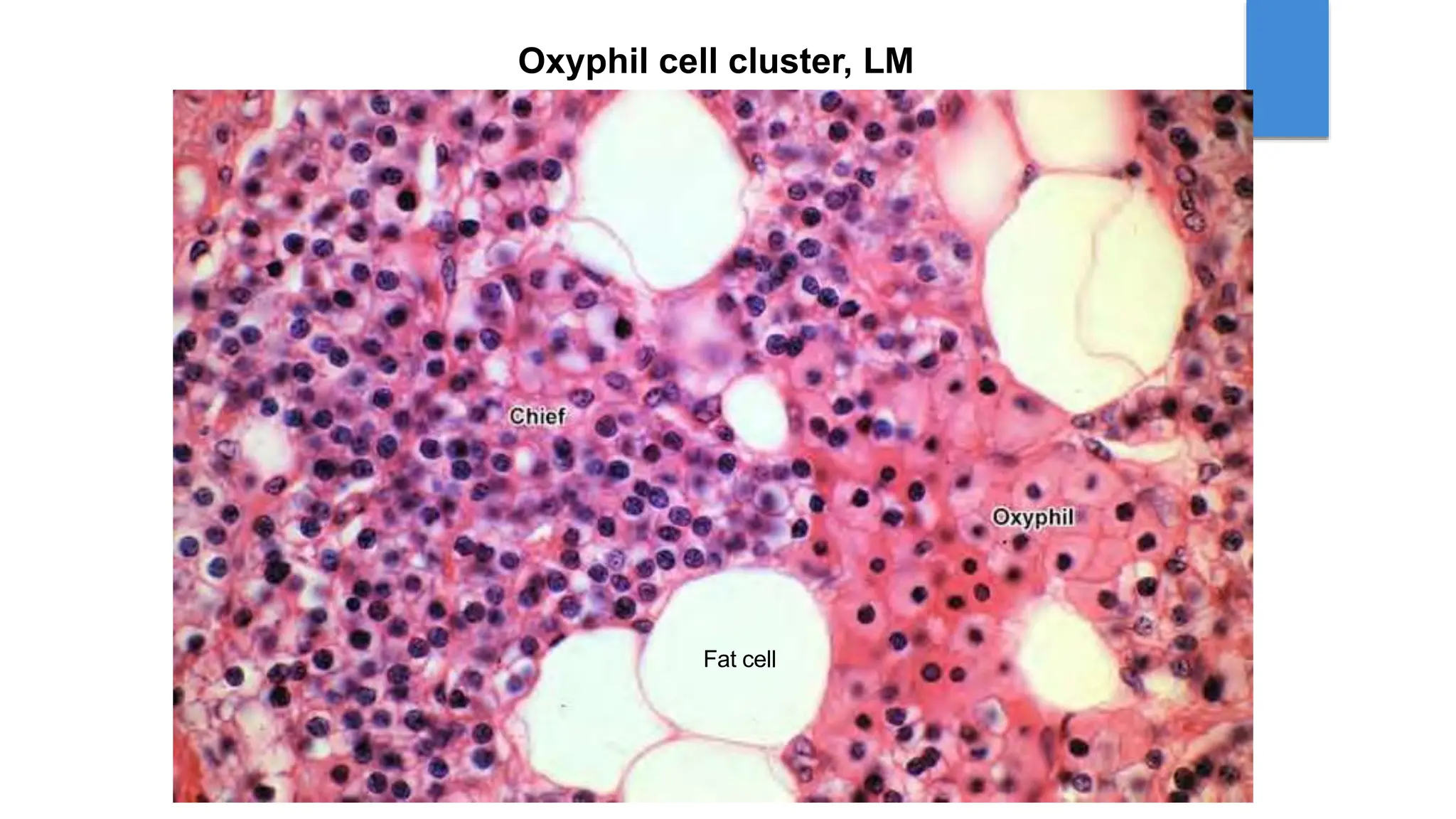 Parathyroid Glands- Gross Anatomy & Histology by Dr. Rabia Inam ...
