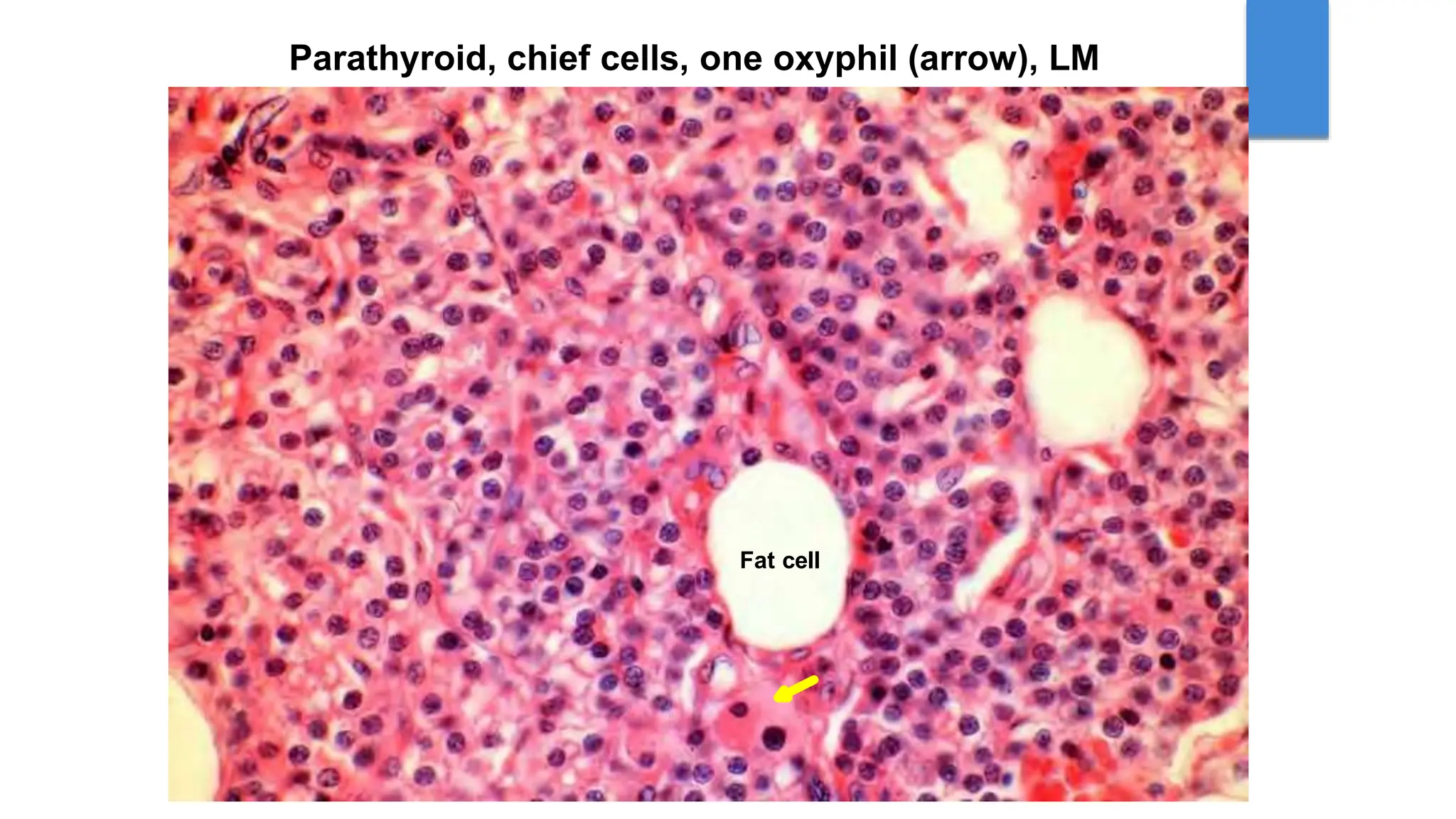 Parathyroid Glands- Gross Anatomy & Histology by Dr. Rabia Inam ...