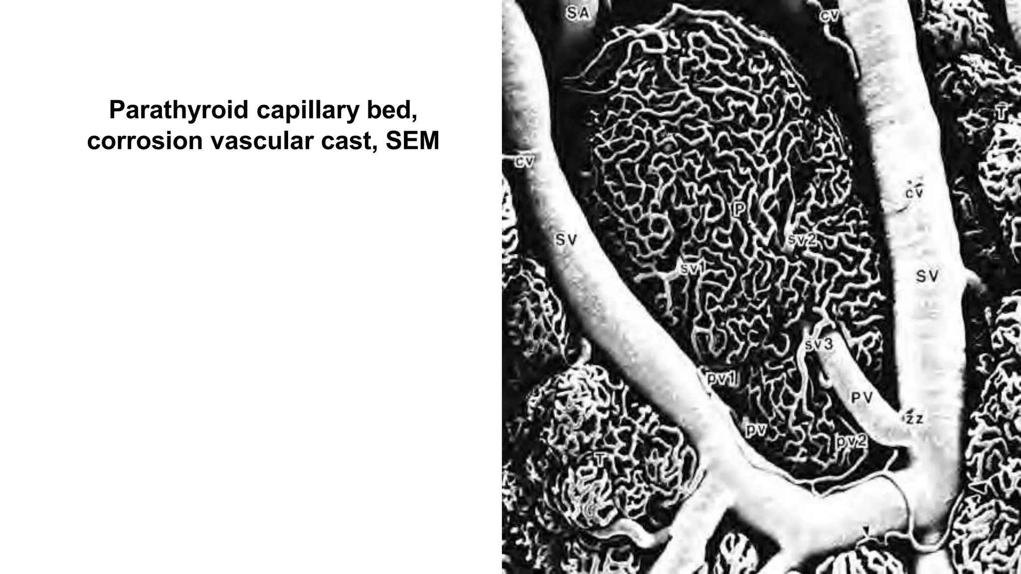 Parathyroid Glands- Gross Anatomy & Histology by Dr. Rabia Inam ...