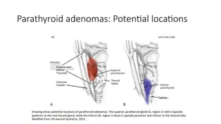 Parathyroid gland Ultrasound scan presentation | PPTX