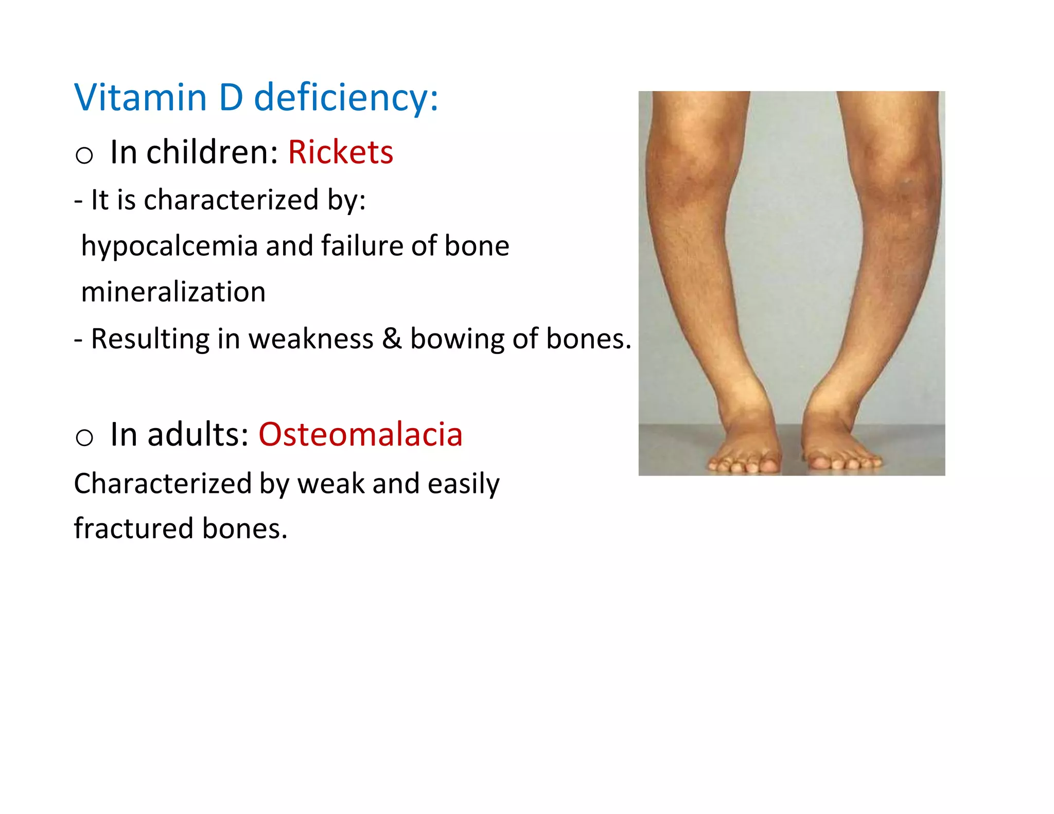 Parathyroid Hormone, Calcitonin, Vitamin D.docx