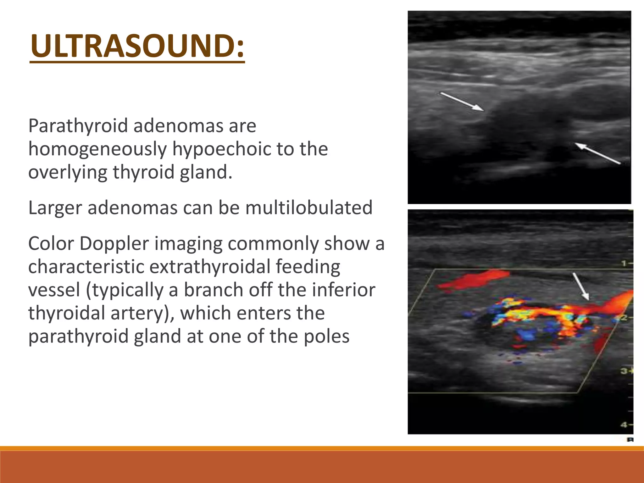 Parathyroid Imaging .pptx