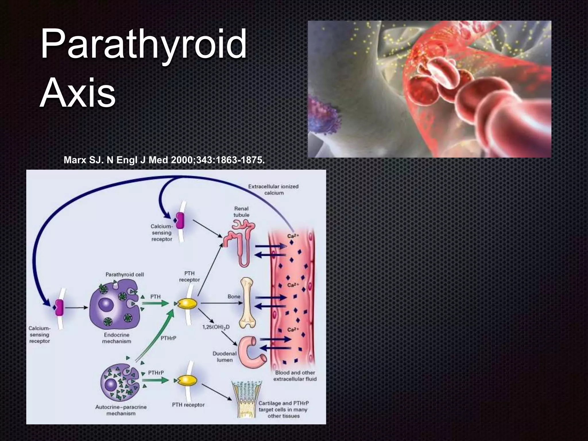 The Many Faces of Hyperparathyroidism & Advances in Treatment | PPTX