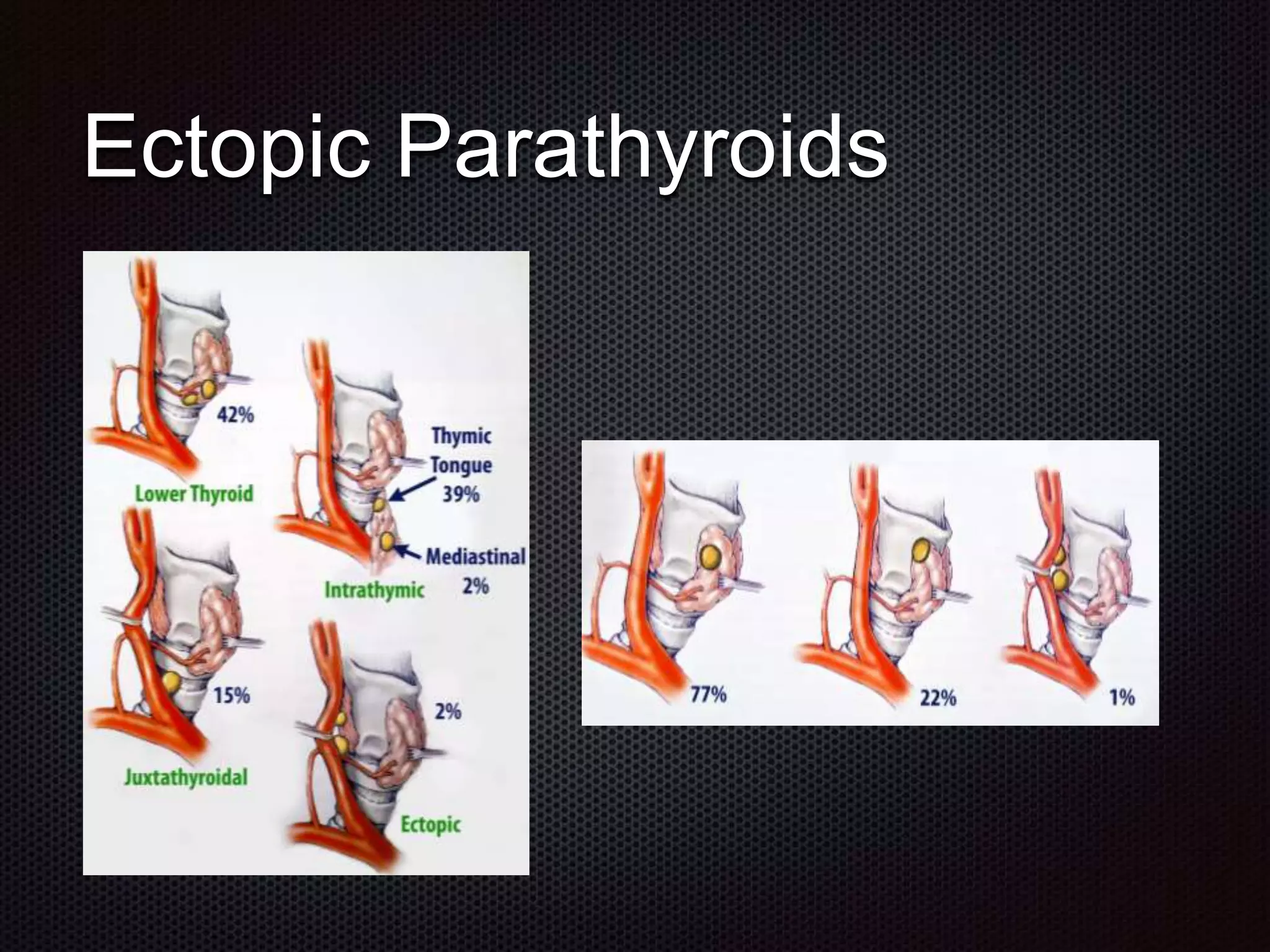 The Many Faces of Hyperparathyroidism & Advances in Treatment | PPTX