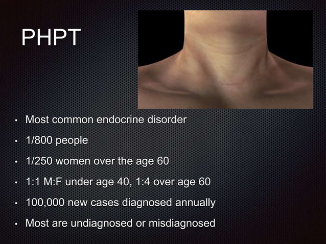 The Many Faces of Hyperparathyroidism & Advances in Treatment | PPTX ...