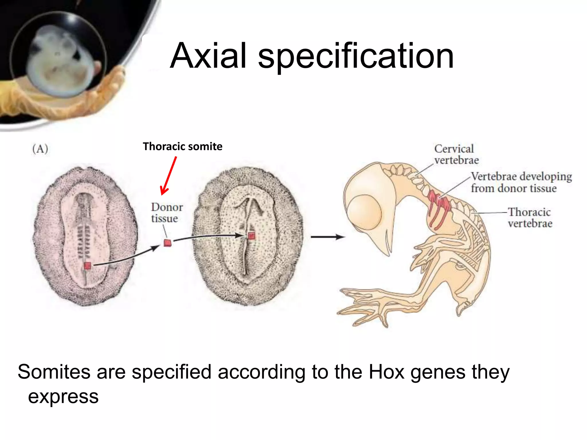 Paraxial and intermediate mesoderm | PPTX