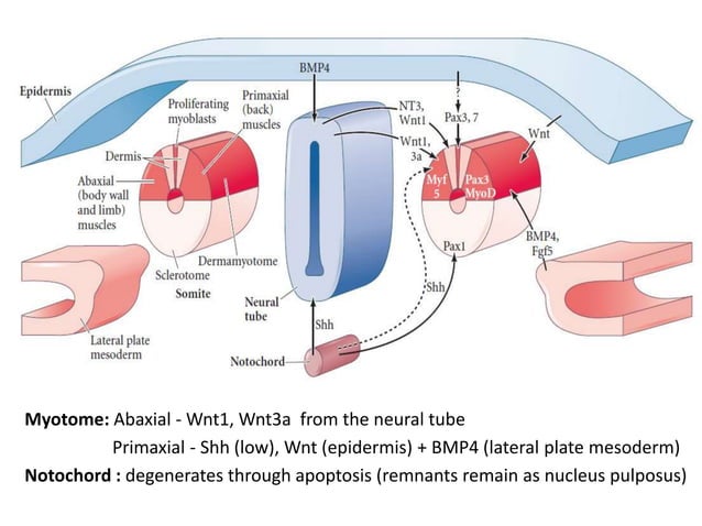 Paraxial and intermediate mesoderm | PPTX | Bone and Joint Conditions ...